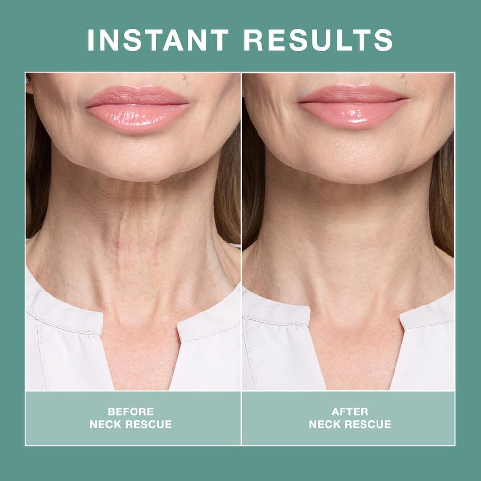 Neck Rescue – Prolux Cosmetics
